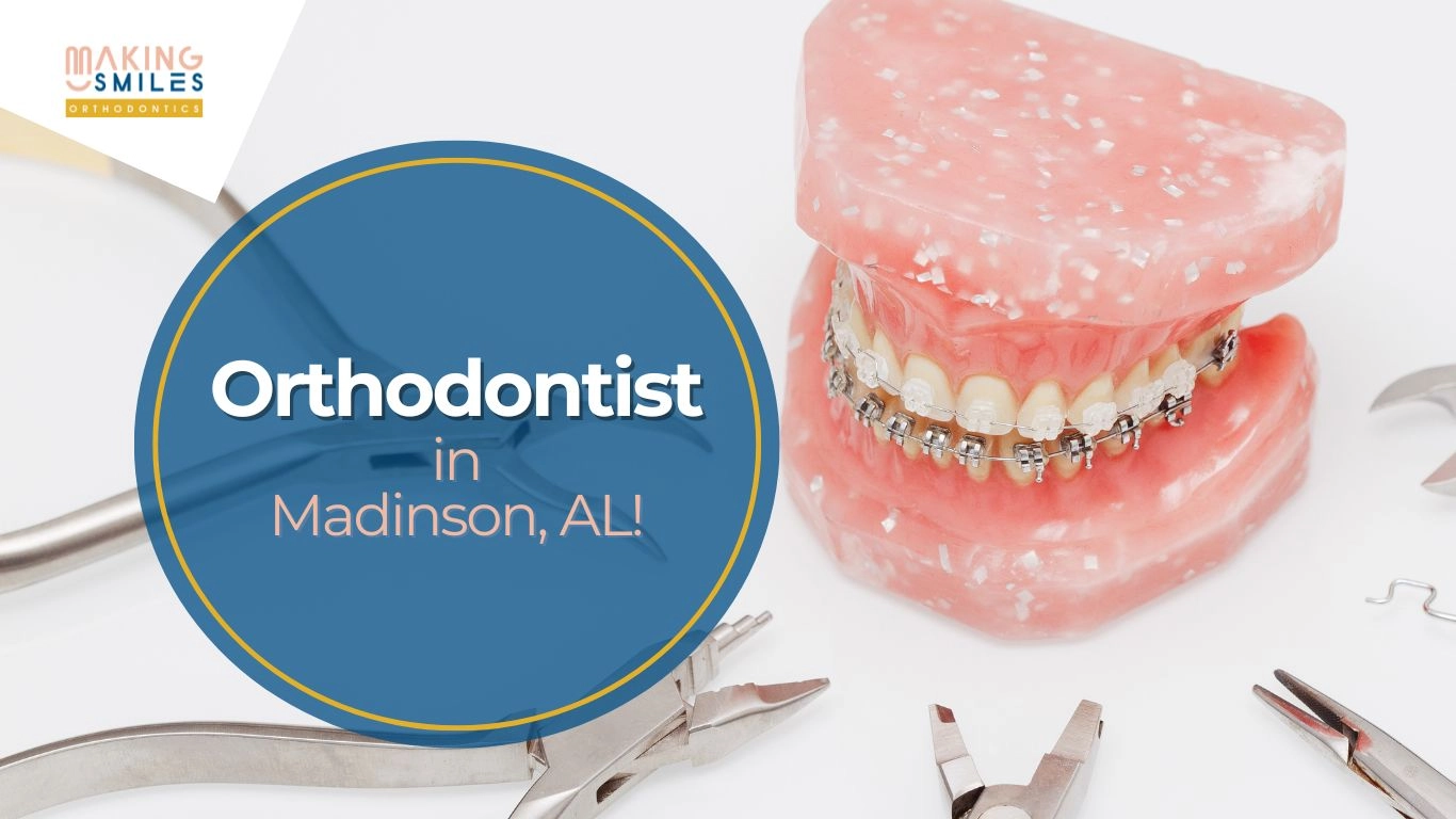 Orthodontist in Madison, AL: Your Guide to Perfecting Your Smile