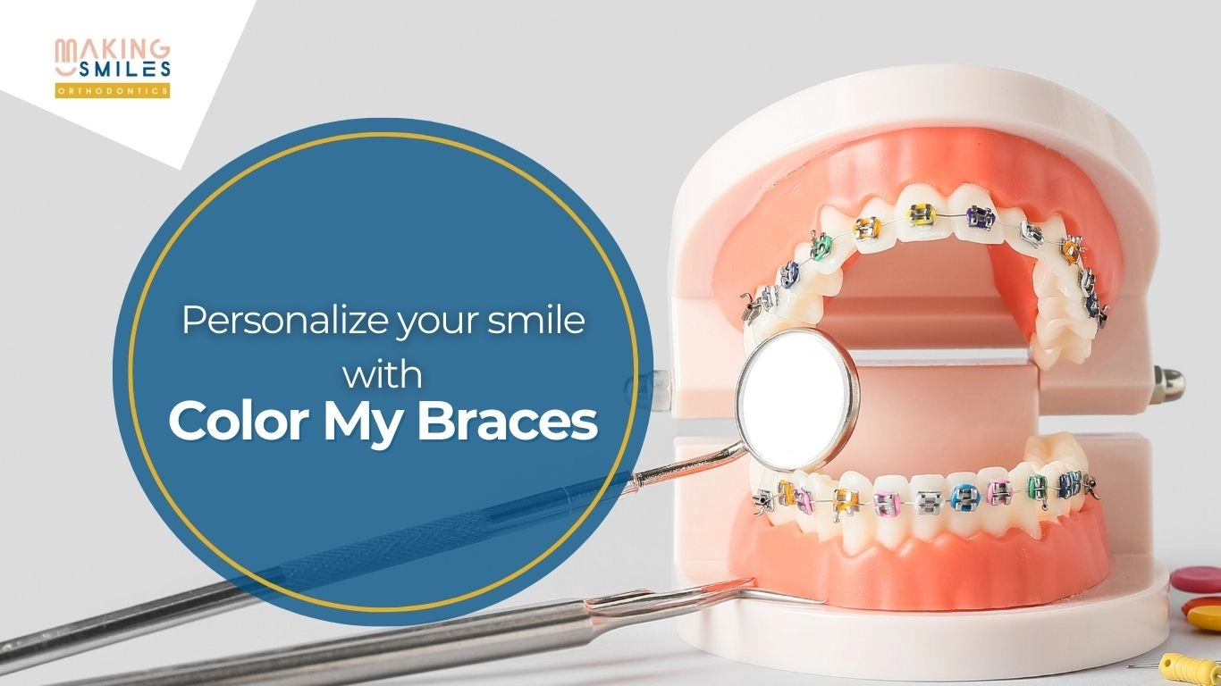 Colorful Braces and Personalized Orthodontics in Madison, AL