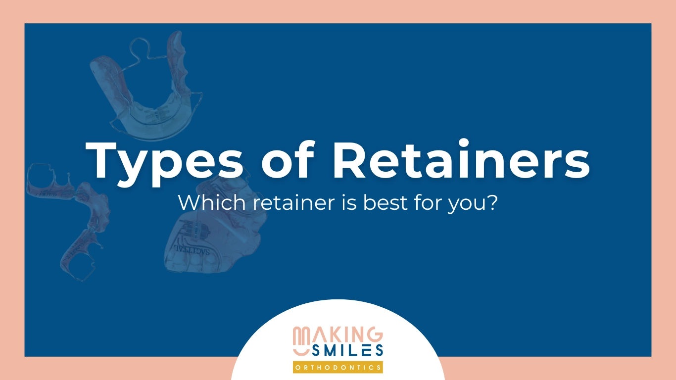 Types of Retainers in Madison, AL